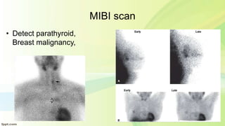 diagnostic evaluation for malignent disease.pptx