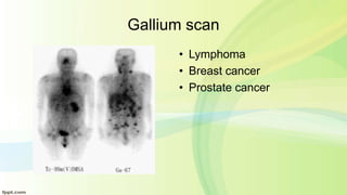 diagnostic evaluation for malignent disease.pptx