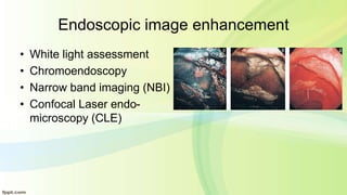 diagnostic evaluation for malignent disease.pptx