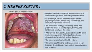 Diagnostic Features of Common Oral Ulcerative Lesions.pptx
