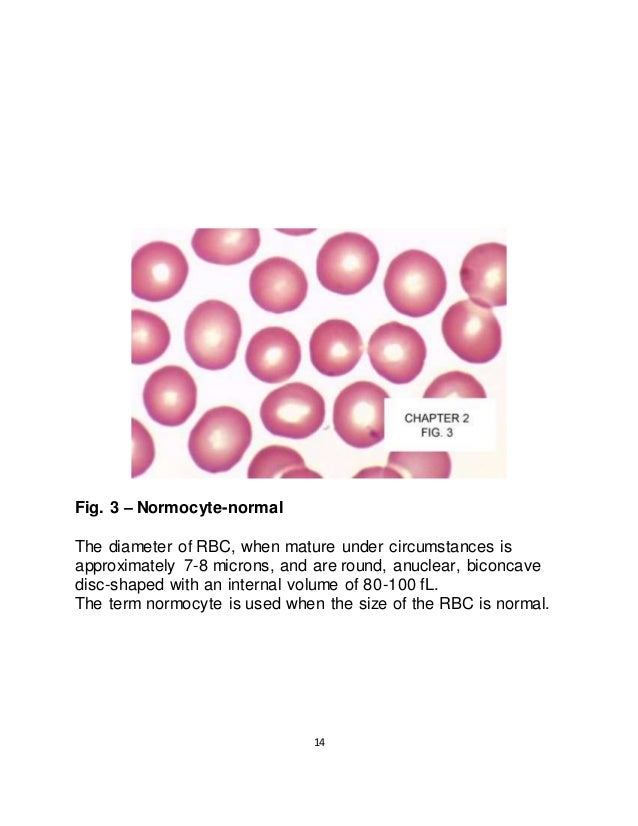 Diagnostic Hemoglobinopathies Second Edition