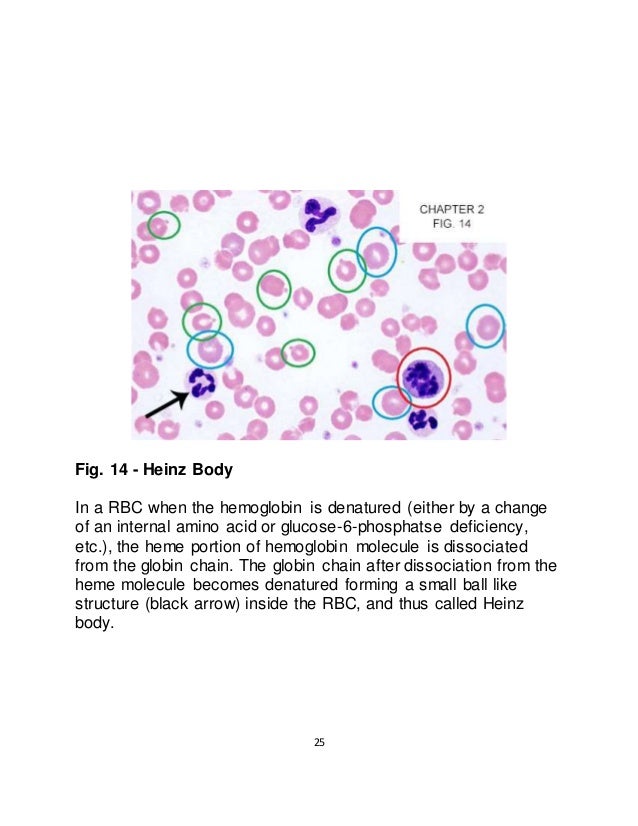 Diagnostic Hemoglobinopathies Second Edition