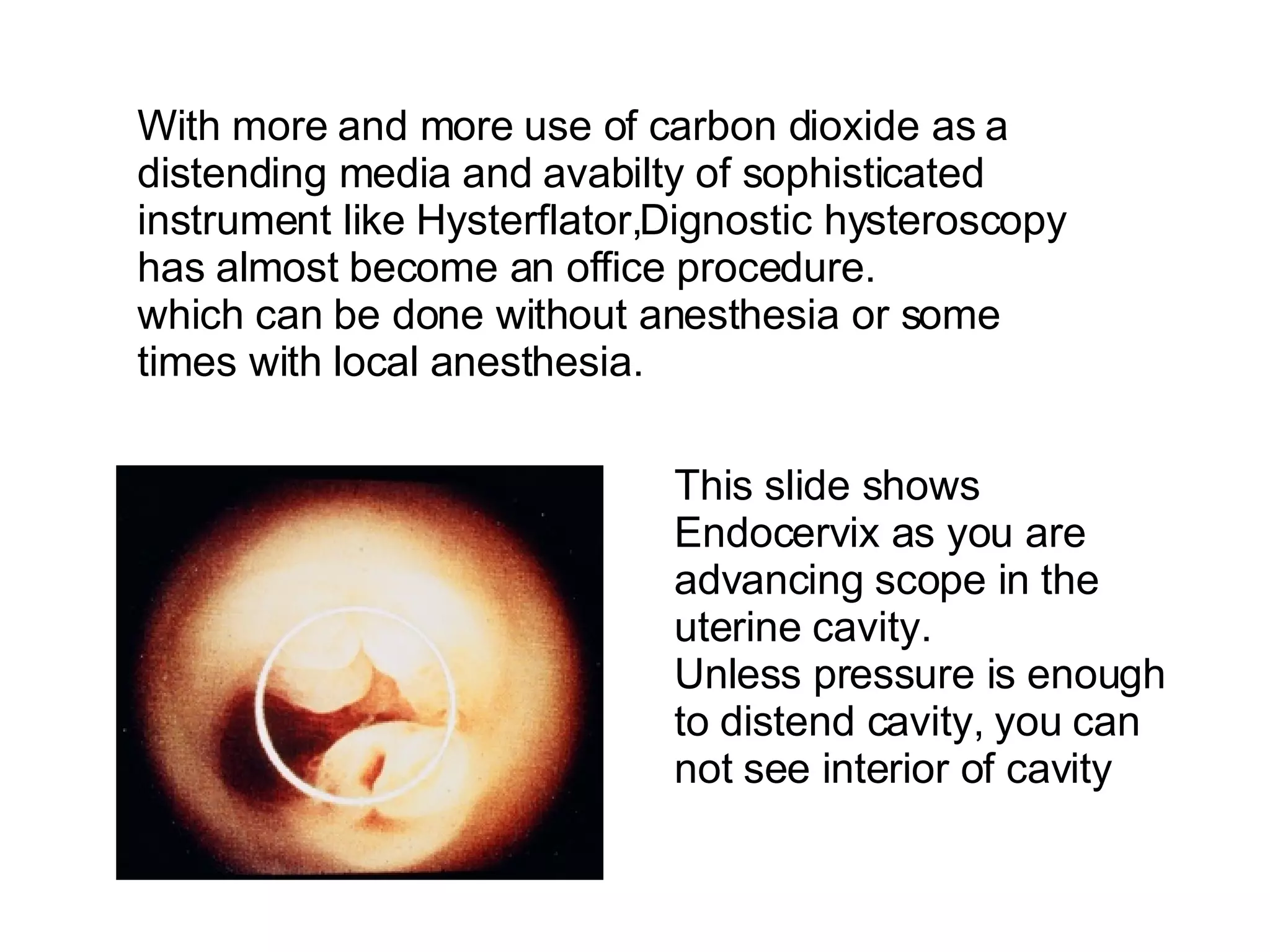 Diagnostic Hysteroscopy Patel | PPT