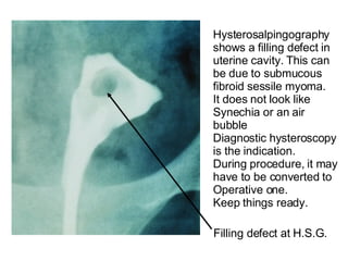 Diagnostic Hysteroscopy Patel | PPT