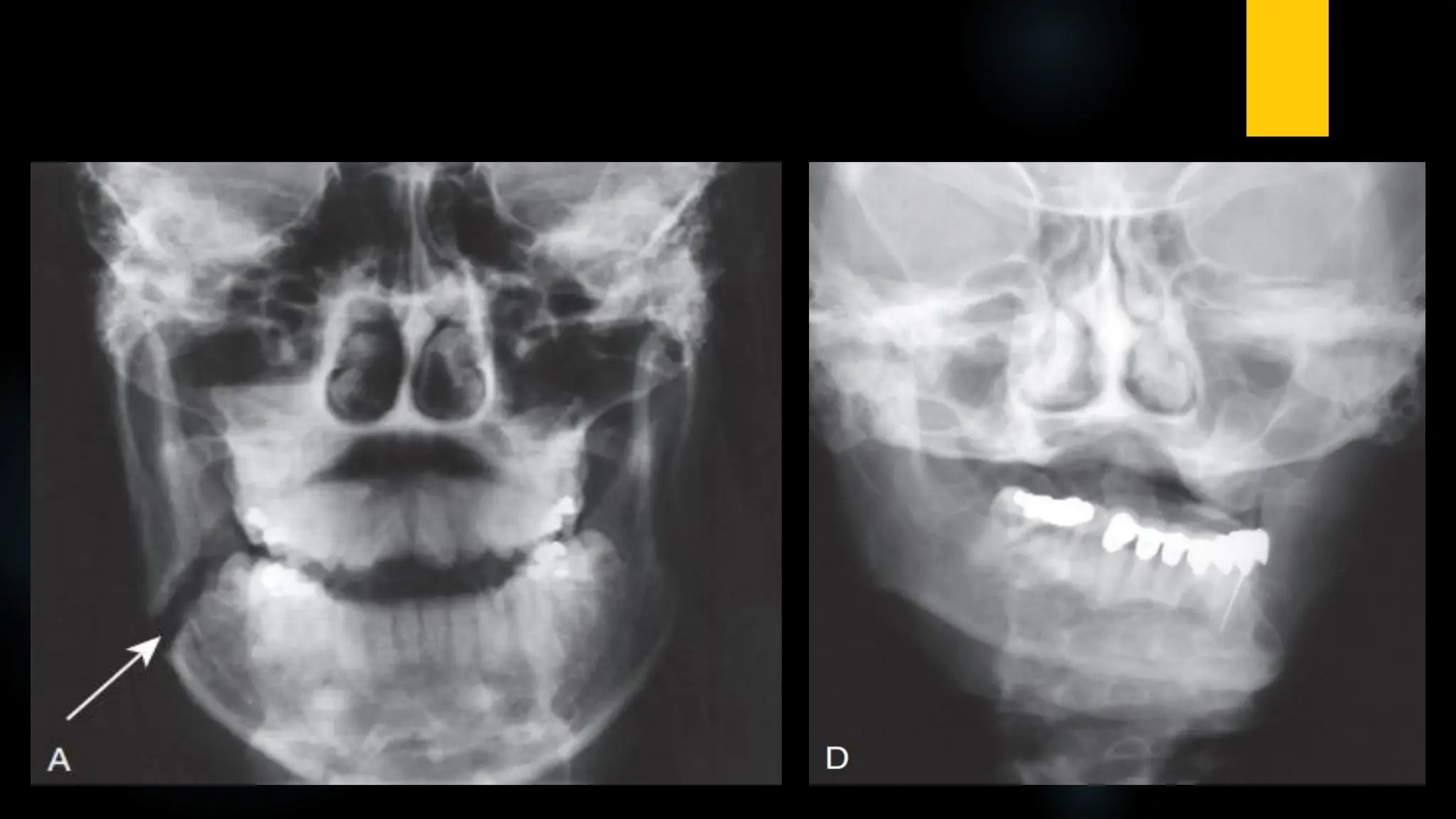 Diagnostic Imaging in Oral and Maxillofacial Surgery | PDF | Bone and ...