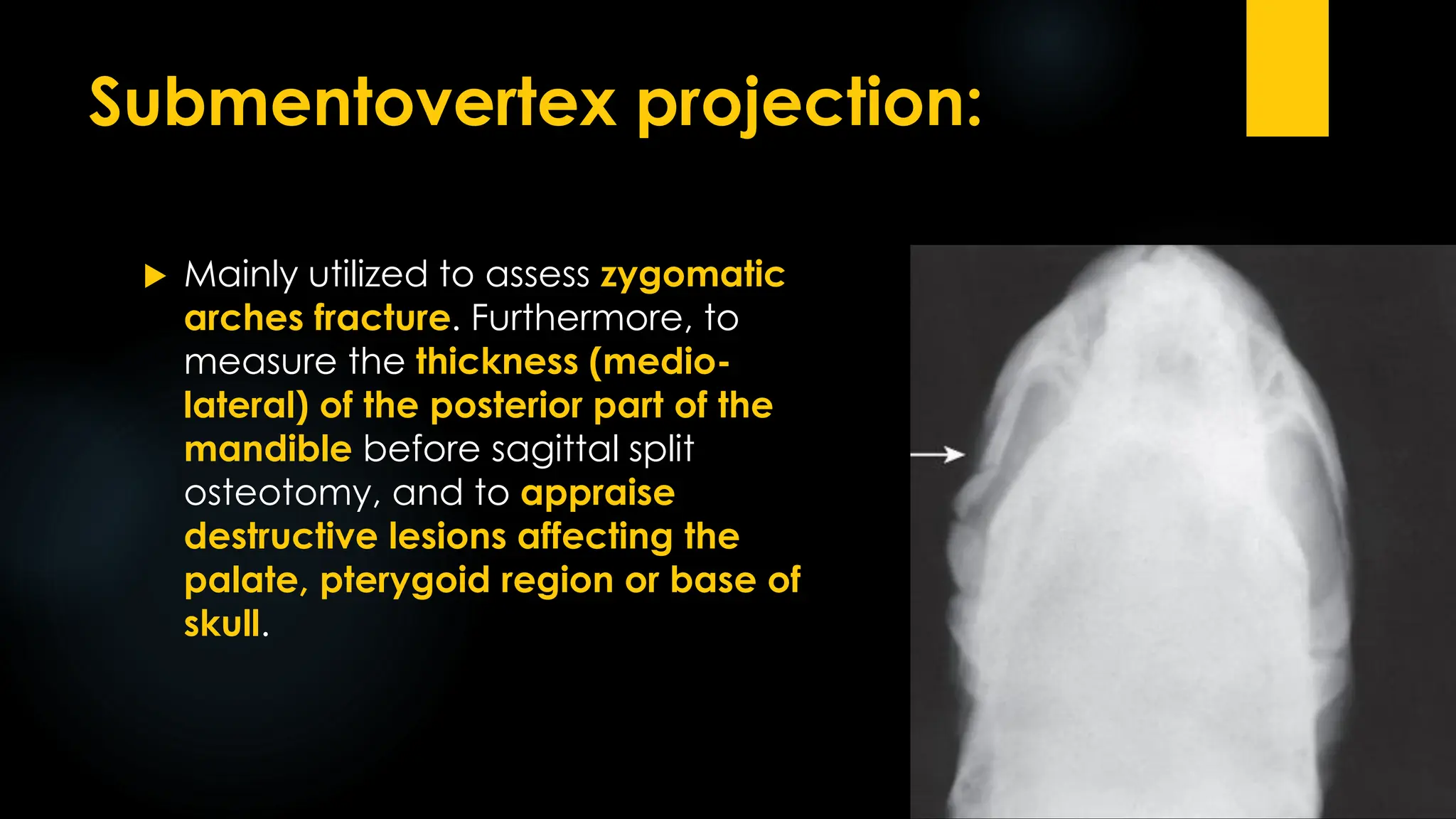 Diagnostic Imaging in Oral and Maxillofacial Surgery | PDF