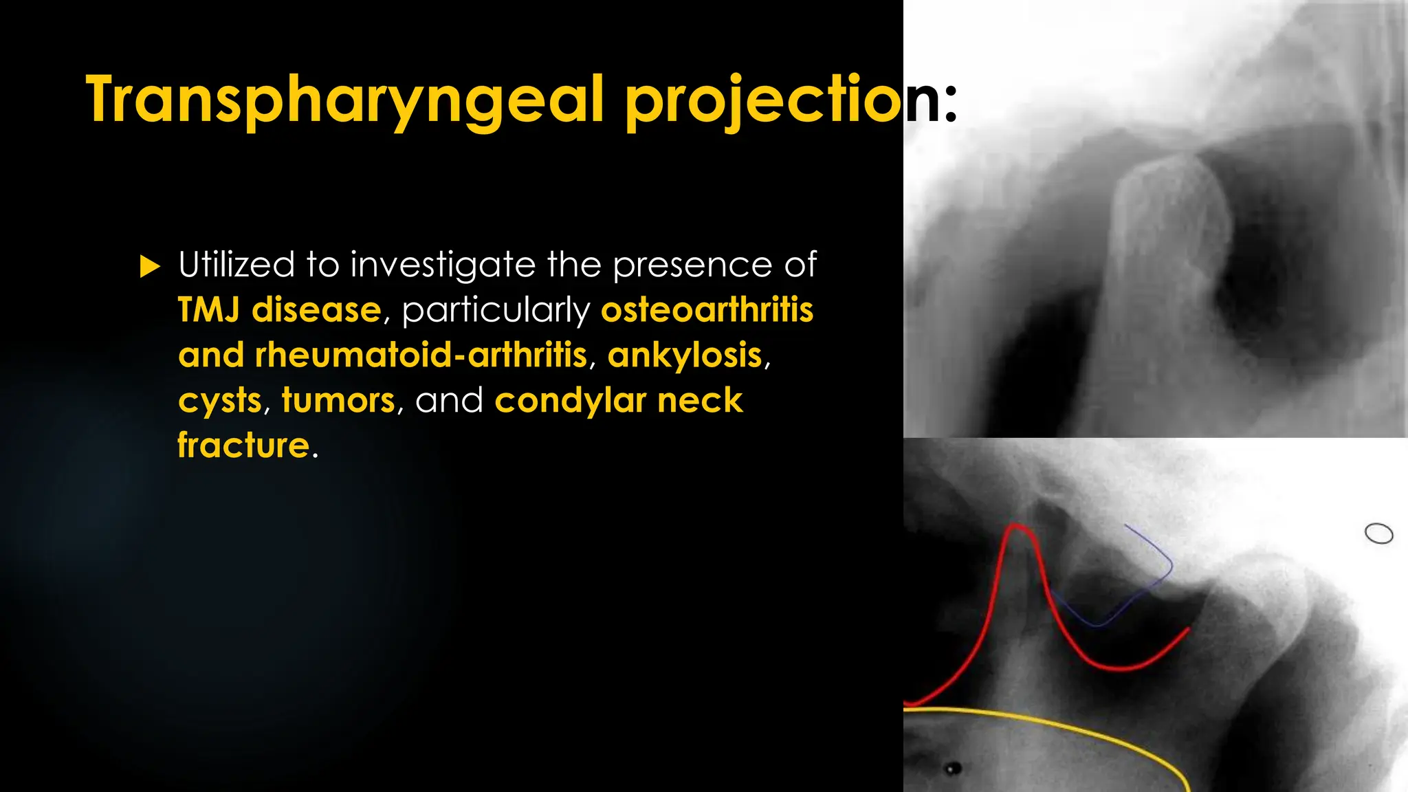 Diagnostic Imaging in Oral and Maxillofacial Surgery | PDF