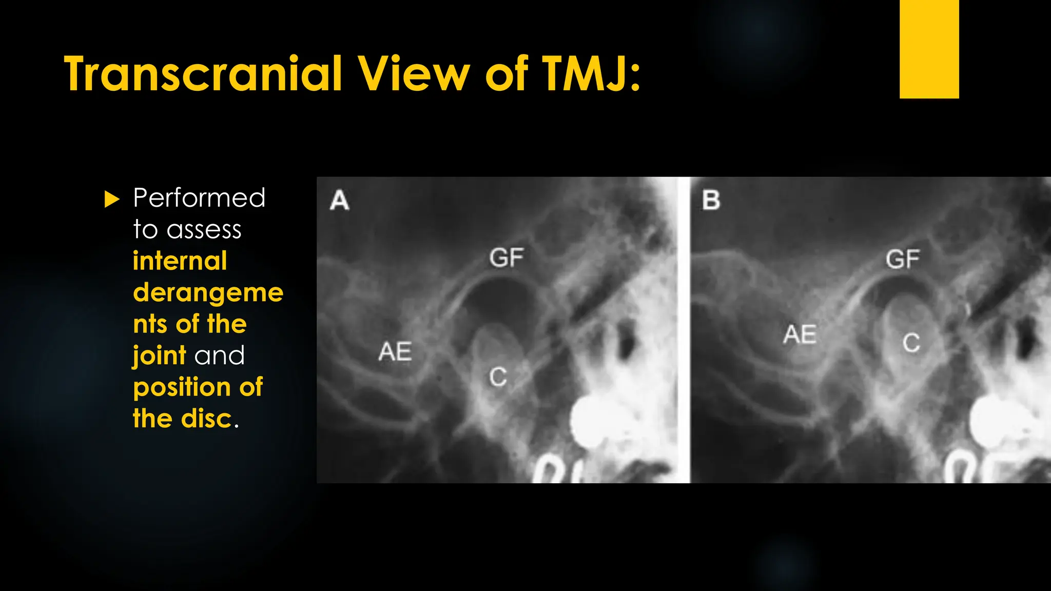 Diagnostic Imaging in Oral and Maxillofacial Surgery | PDF | Bone and ...