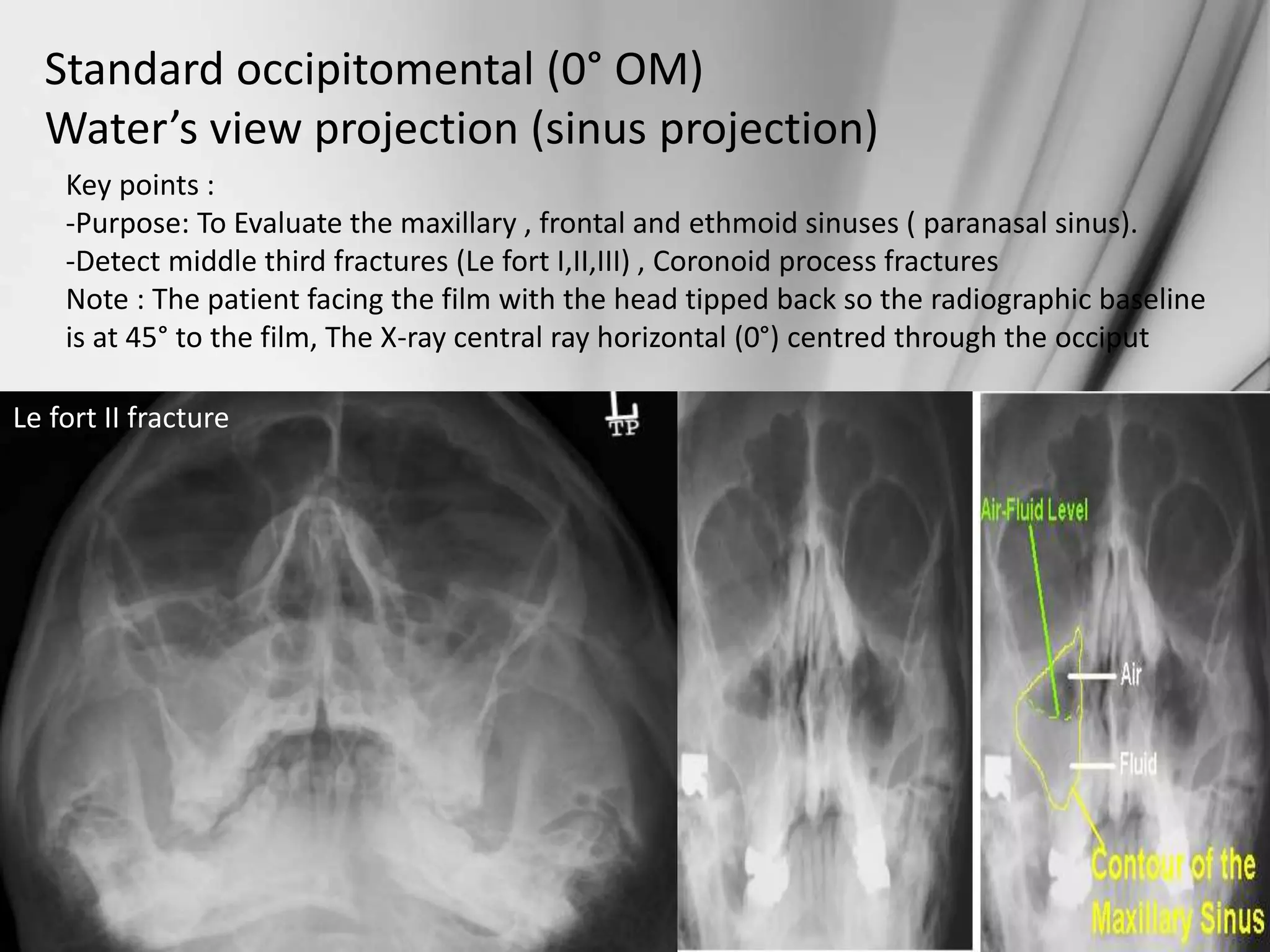 diagnosticimaginginoromaxillofacialsurgery-141214161540-conversion ...