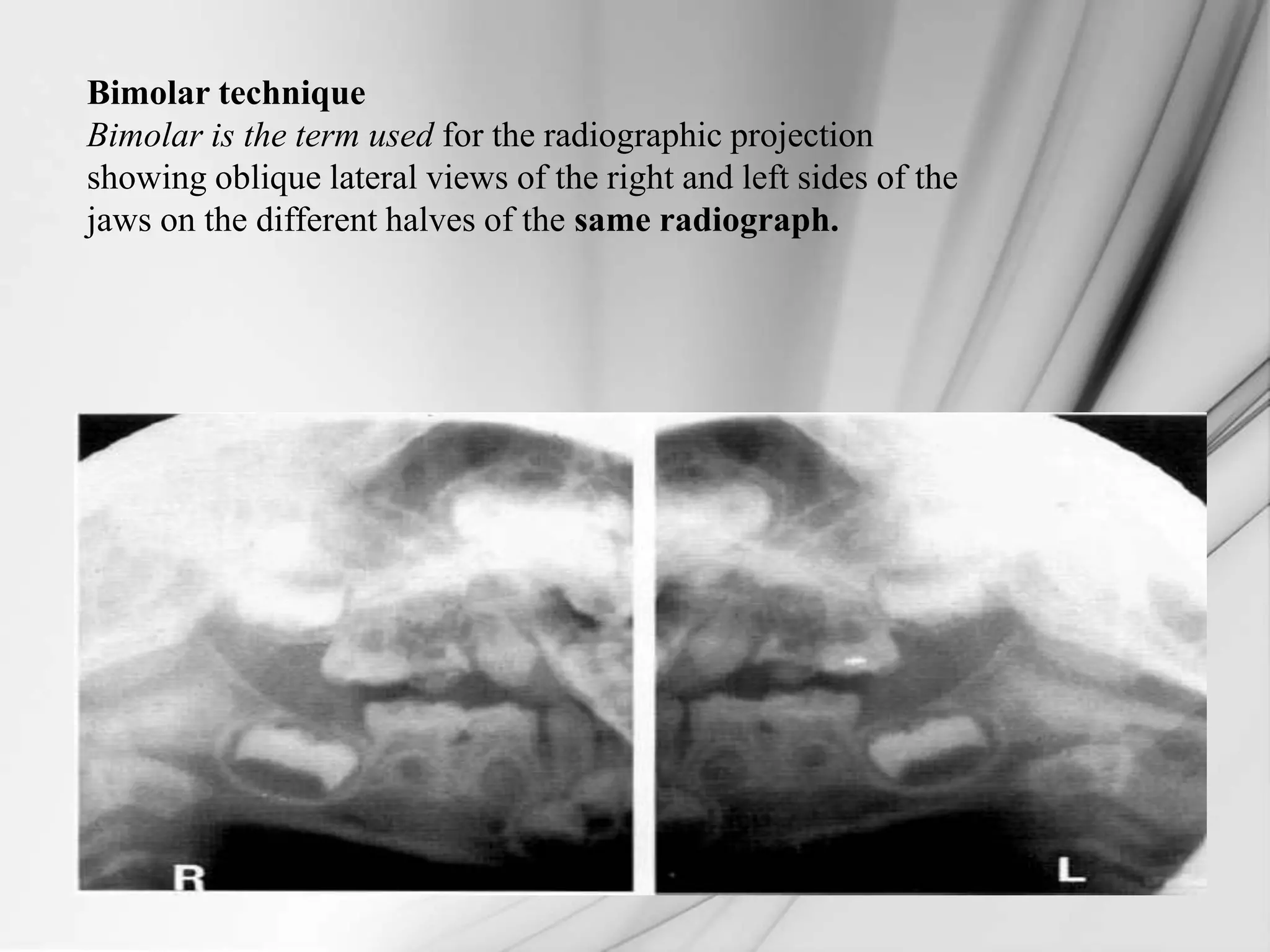 diagnosticimaginginoromaxillofacialsurgery-141214161540-conversion ...