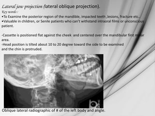 diagnosticimaginginoromaxillofacialsurgery-141214161540-conversion ...