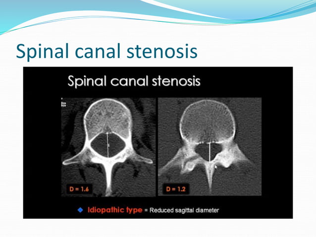 Diagnostic imaging in orthopaedics | PPTX