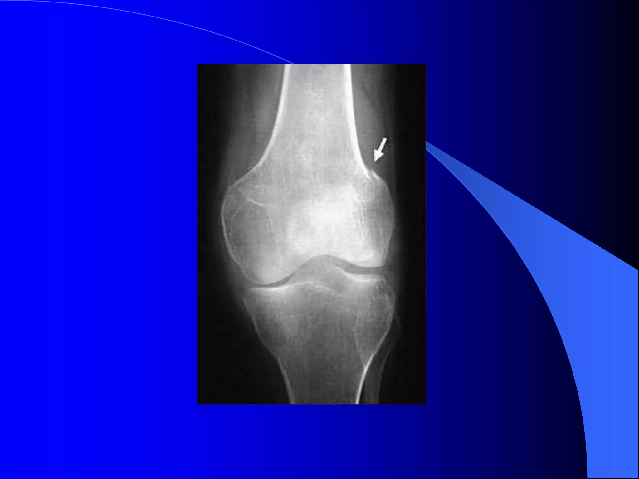 Diagnostic Imaging of Bones and Joints.pptx