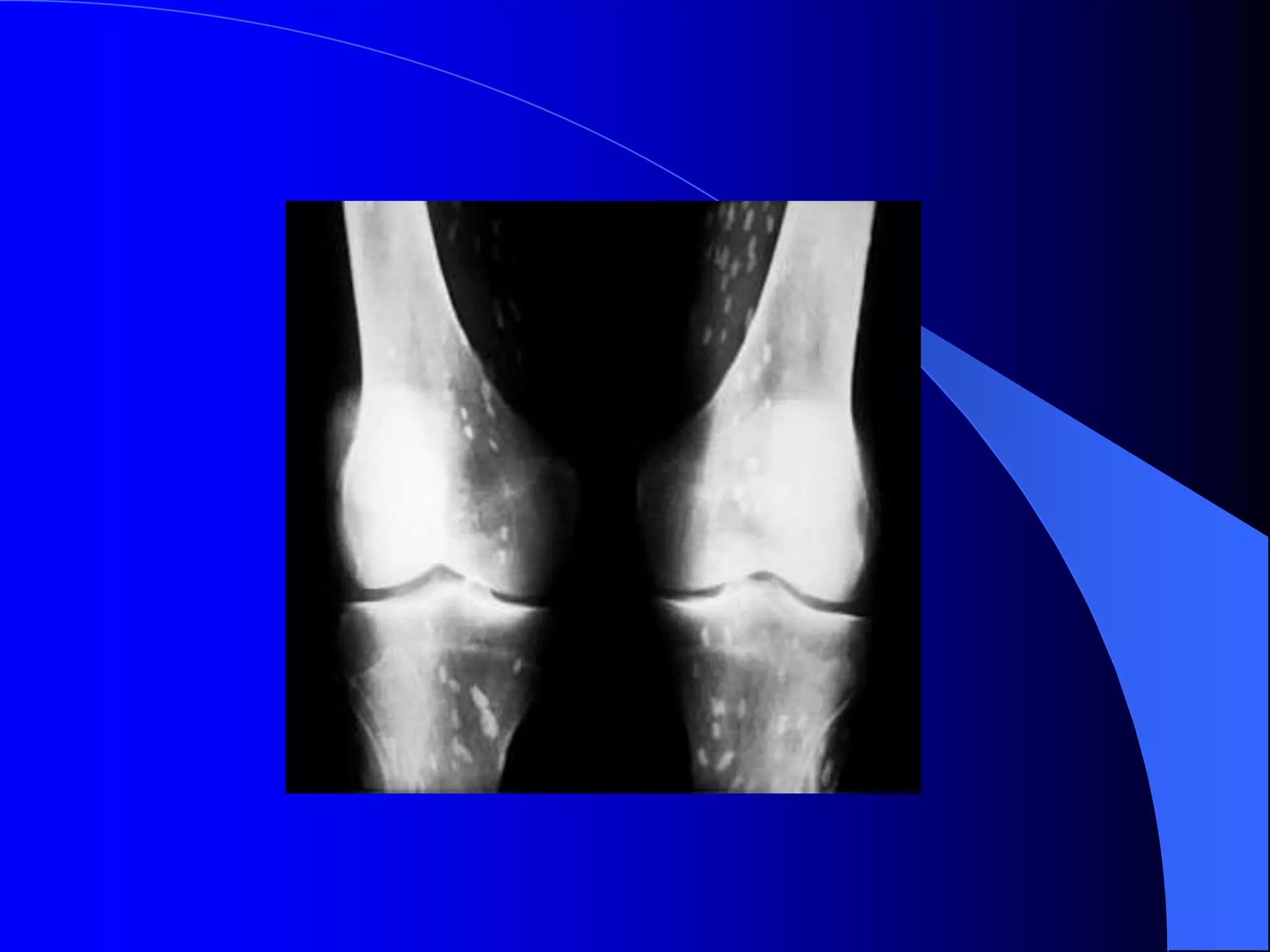 Diagnostic Imaging of Bones and Joints.pptx