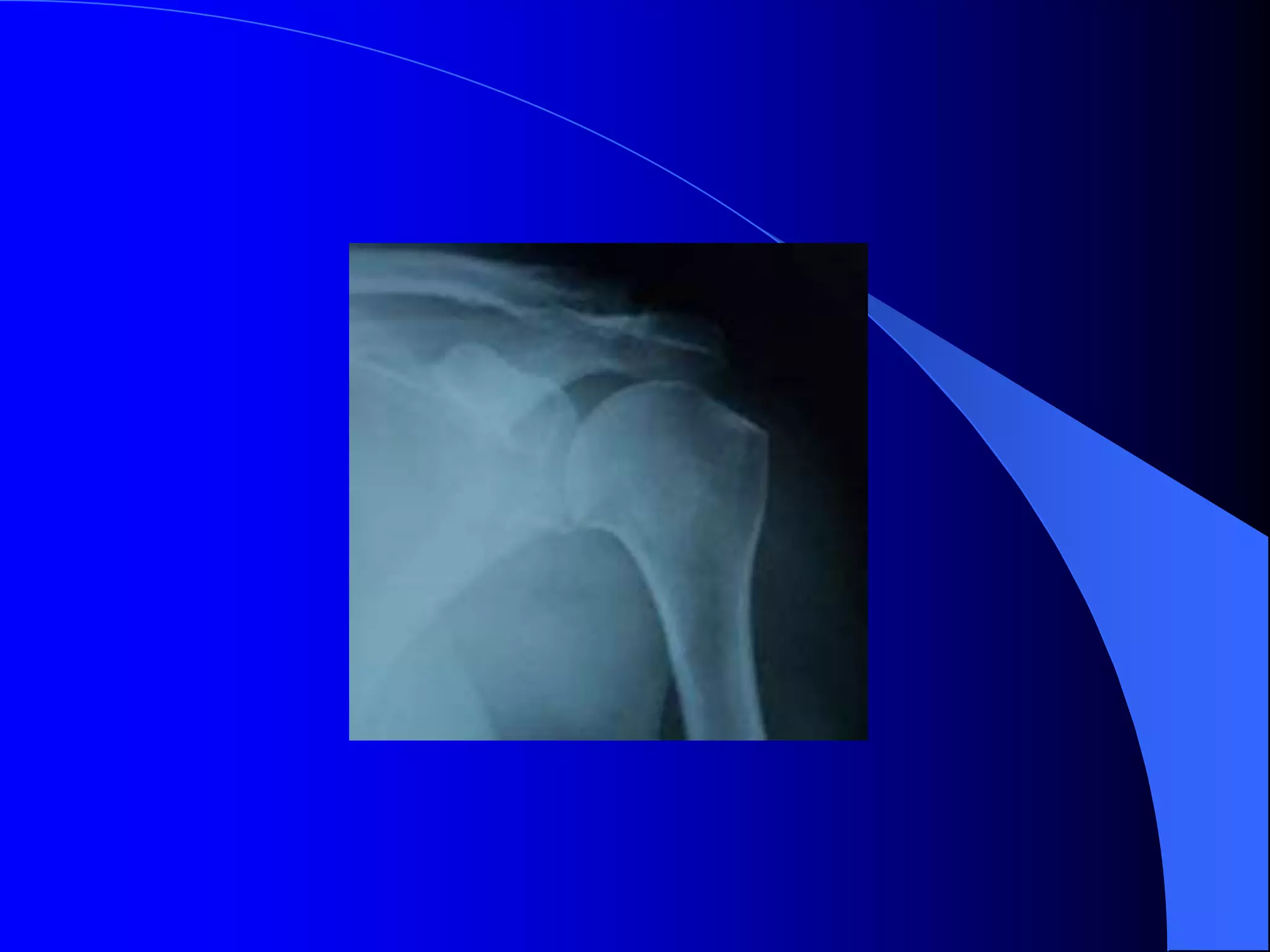 Diagnostic Imaging of Bones and Joints.pptx