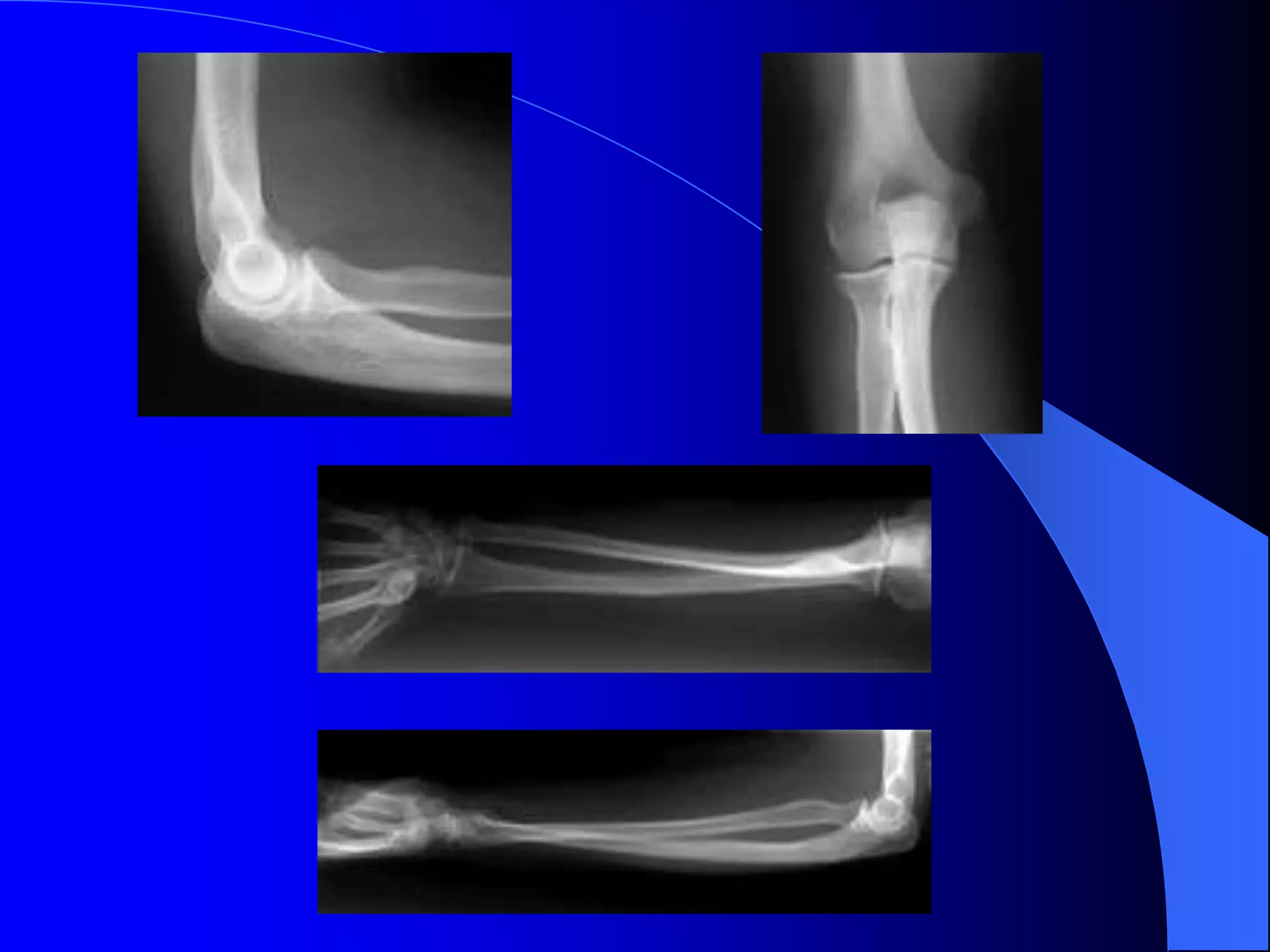 Diagnostic imaging of bones and joints (1) | PPTX