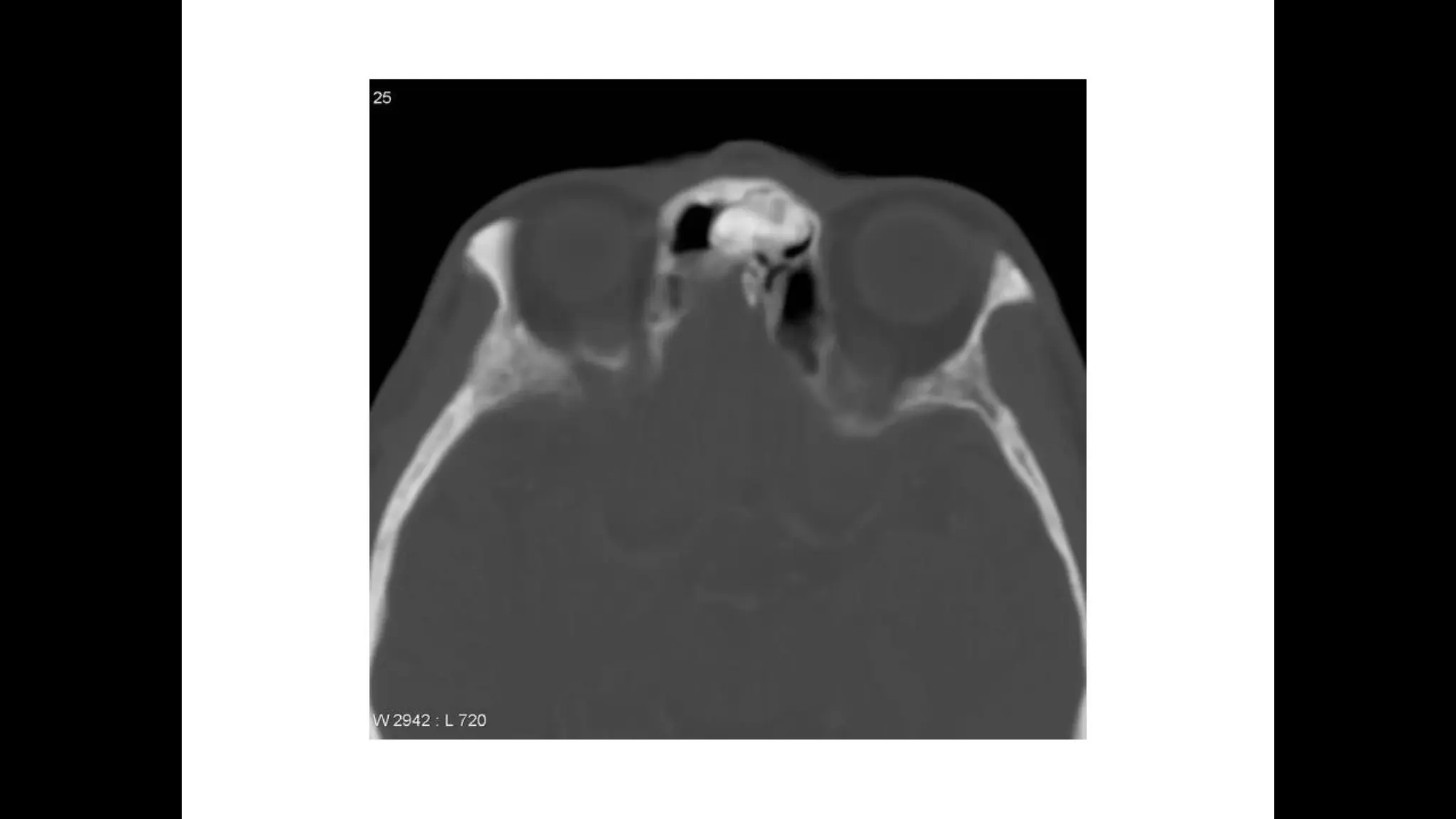 Diagnostic Imaging of Bone mass and Tumors.pptx