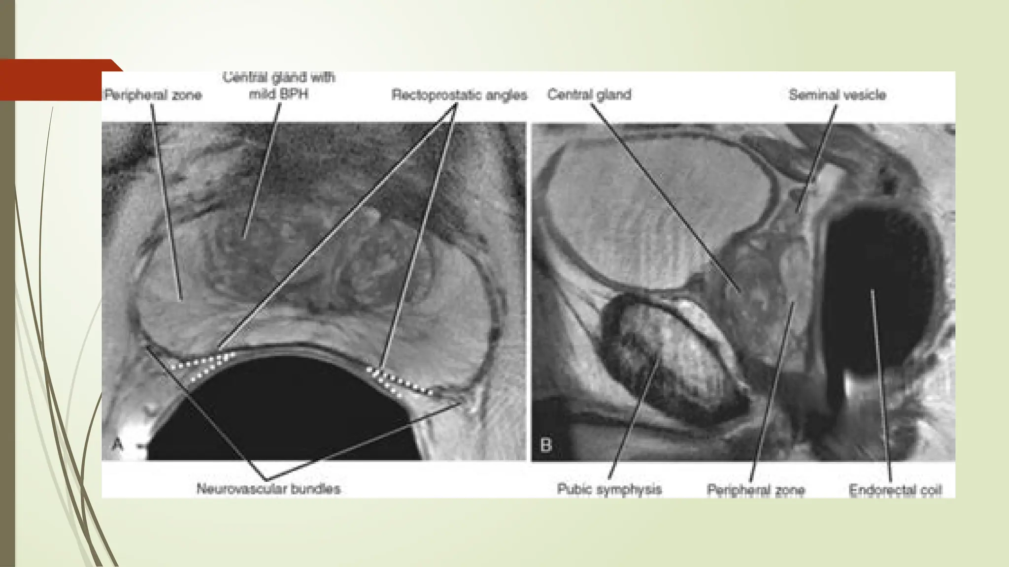 diagnostic imaging of reproductive system.pptx