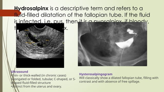 diagnostic imaging of reproductive system.pptx