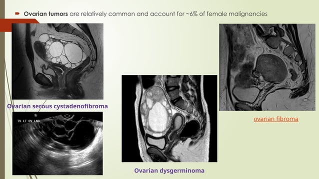 diagnostic imaging of reproductive system.pptx
