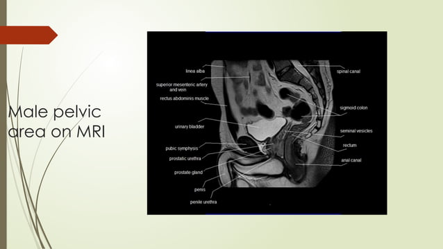 diagnostic imaging of reproductive system.pptx