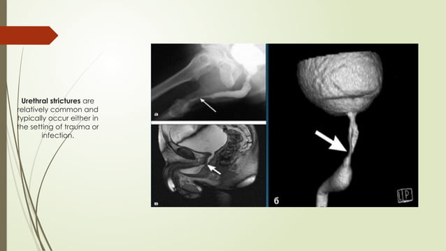 diagnostic imaging of reproductive system.pptx