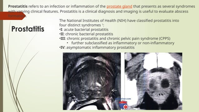 diagnostic imaging of reproductive system.pptx