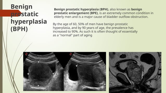 diagnostic imaging of reproductive system.pptx