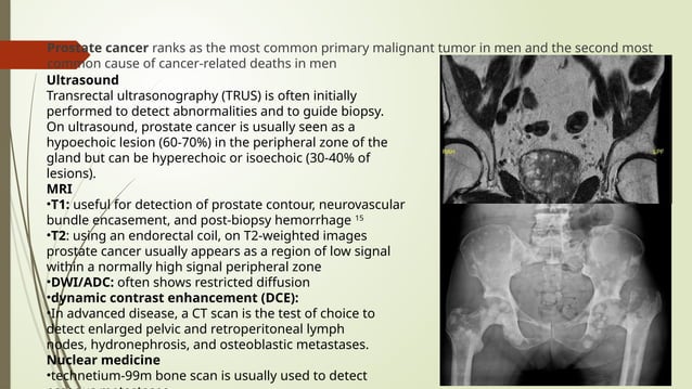 diagnostic imaging of reproductive system.pptx