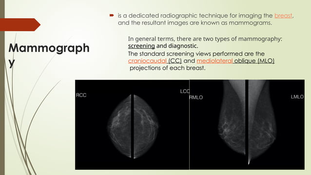 diagnostic imaging of reproductive system.pptx
