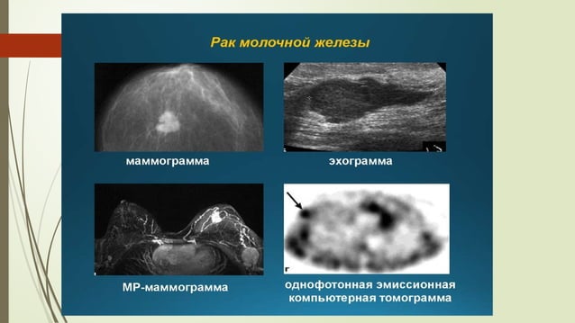 diagnostic imaging of reproductive system.pptx