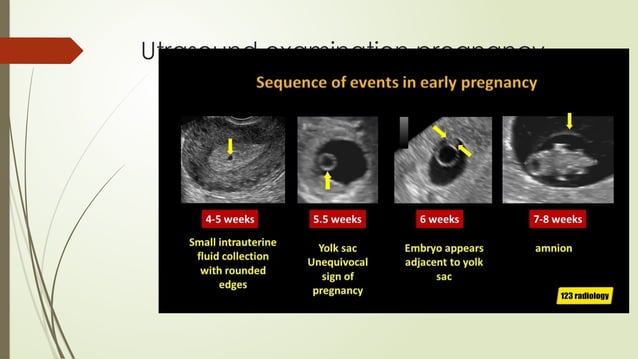 diagnostic imaging of reproductive system.pptx