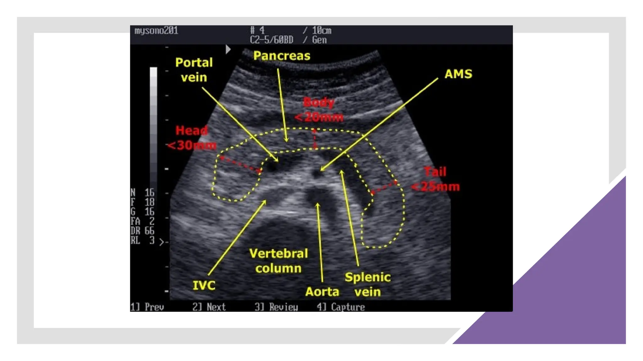 Diagnostic Imaging of the Pancreas and Spleen.pptx