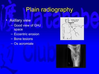 Diagnostic imaging of the shoulder - Chris Roberts | PPT