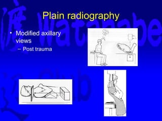 Diagnostic imaging of the shoulder - Chris Roberts | PPT