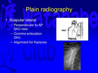 Diagnostic imaging of the shoulder - Chris Roberts | PPT