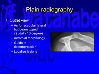 Diagnostic imaging of the shoulder - Chris Roberts | PPT