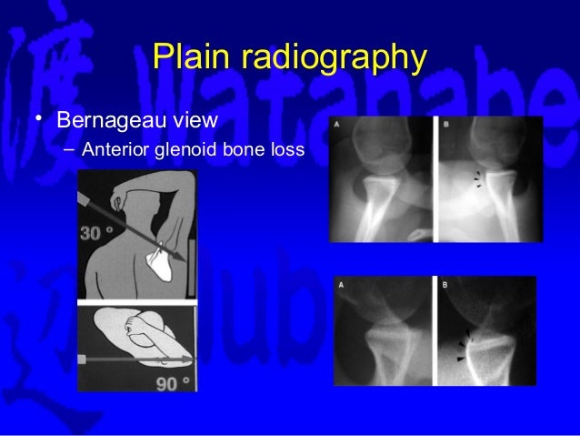 Diagnostic imaging of the shoulder - Chris Roberts