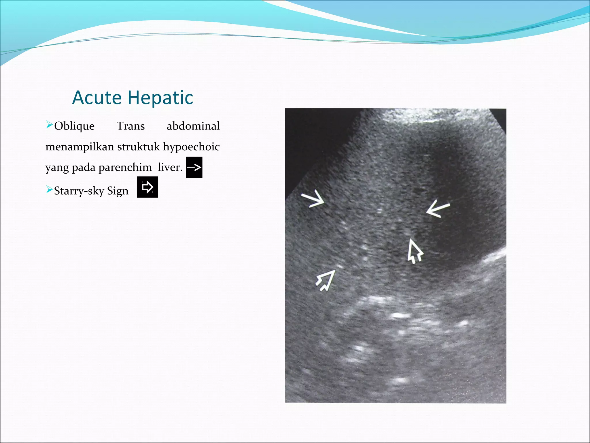 Diagnostic imaging of ultrasound | PPT
