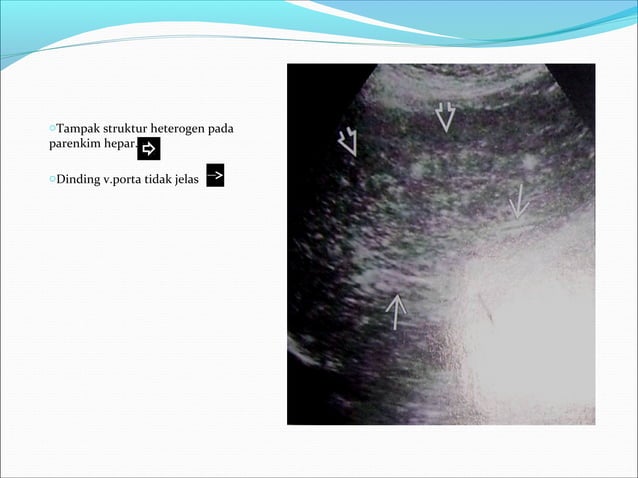 Diagnostic imaging of ultrasound | PPT
