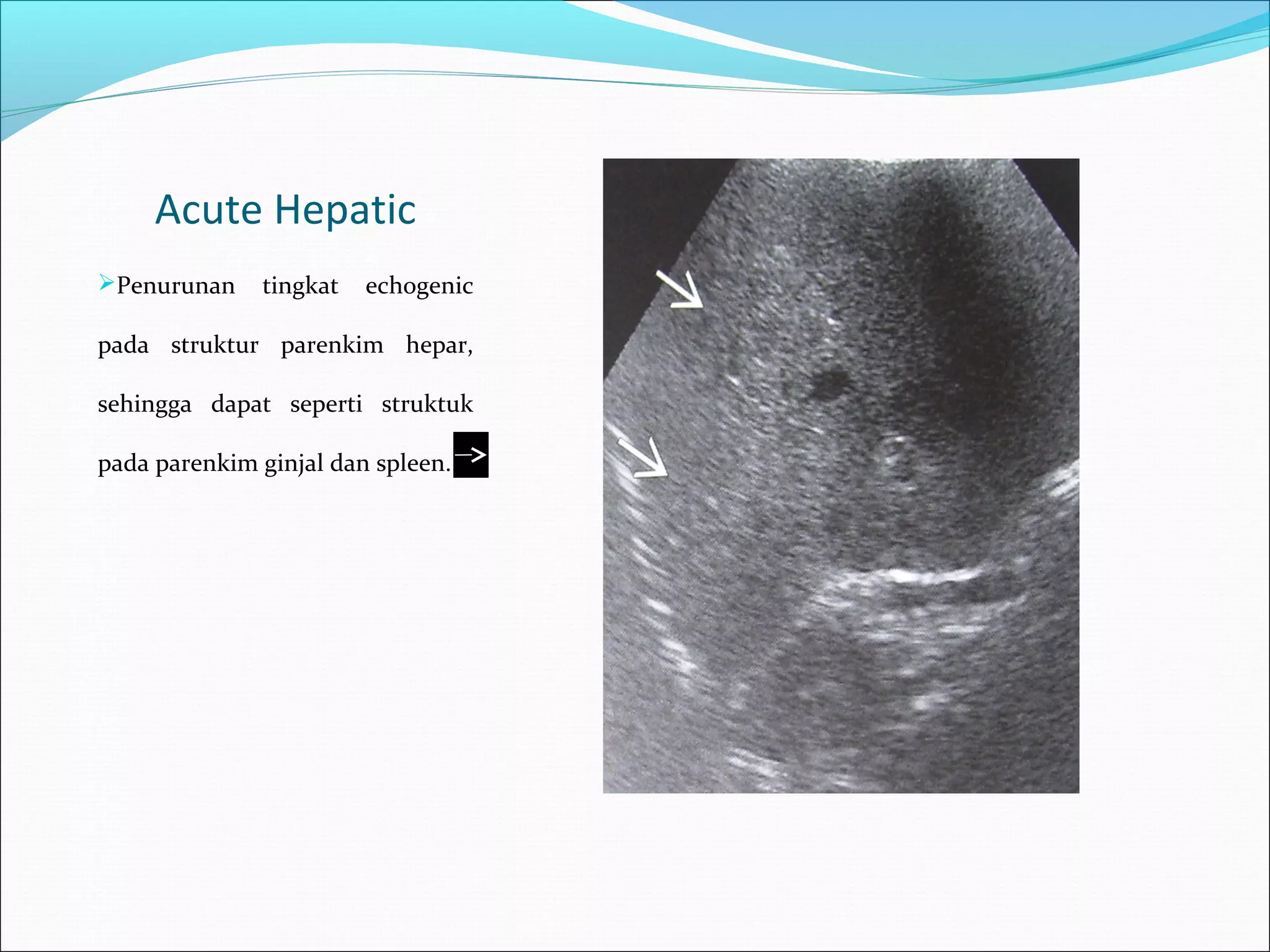 Diagnostic imaging of ultrasound | PPT