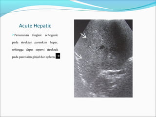 Diagnostic imaging of ultrasound | PPT