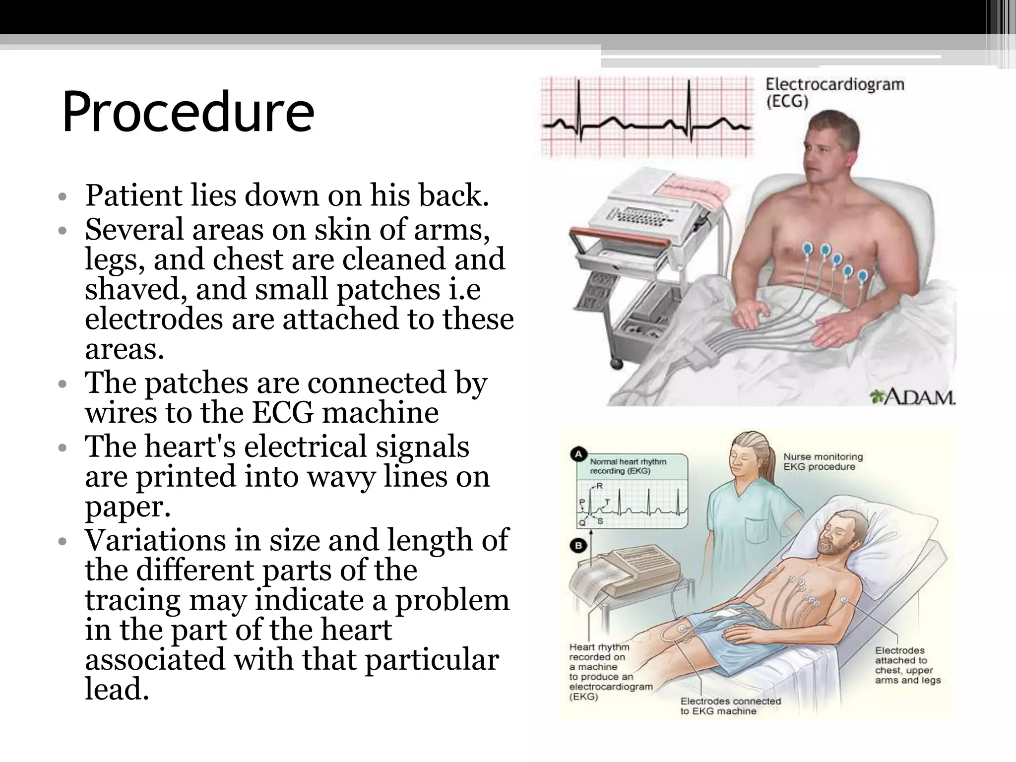 Diagnostic Investigations of Cardiovascular System | PPTX
