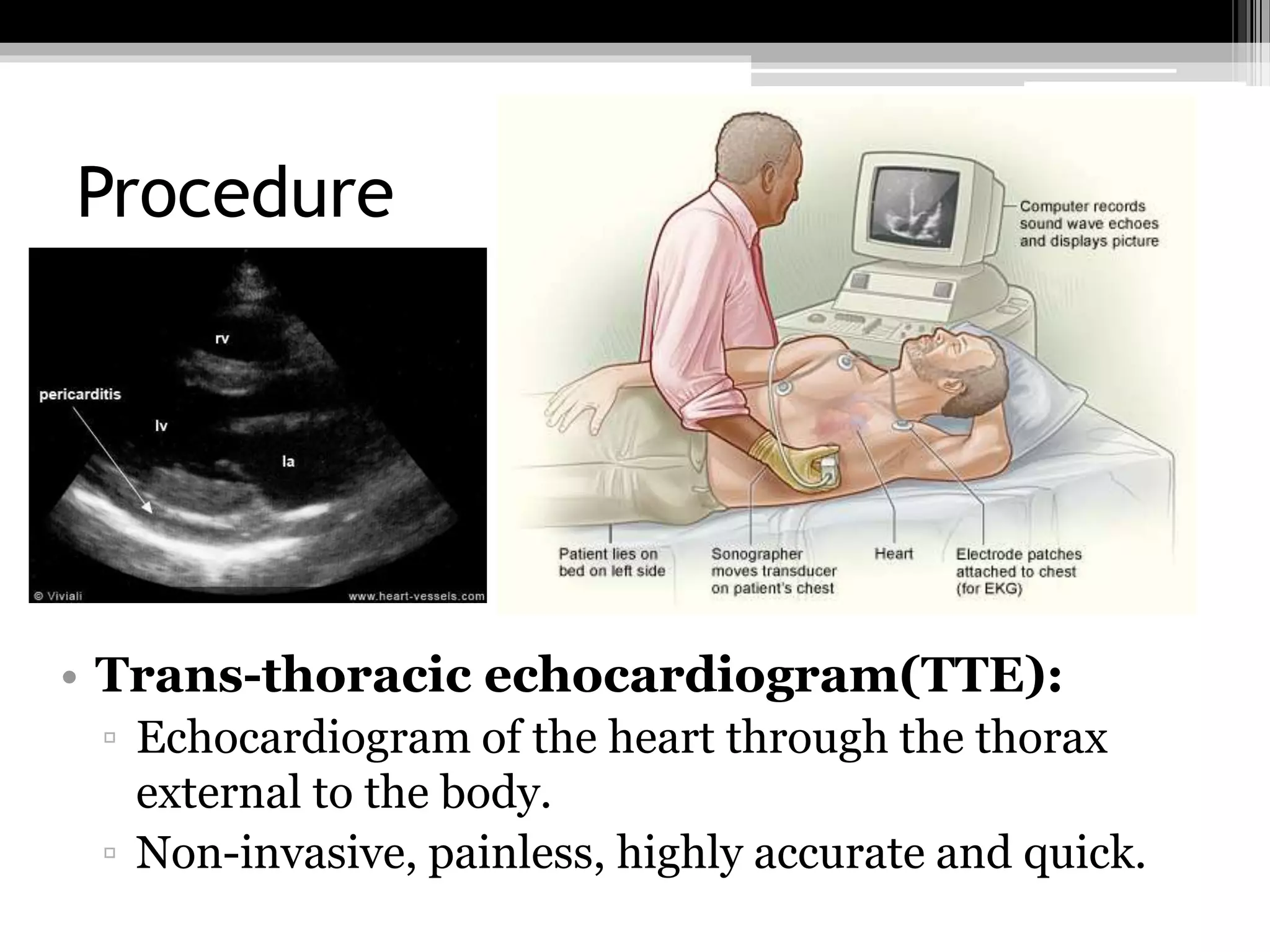 Diagnostic Investigations of Cardiovascular System | PPTX