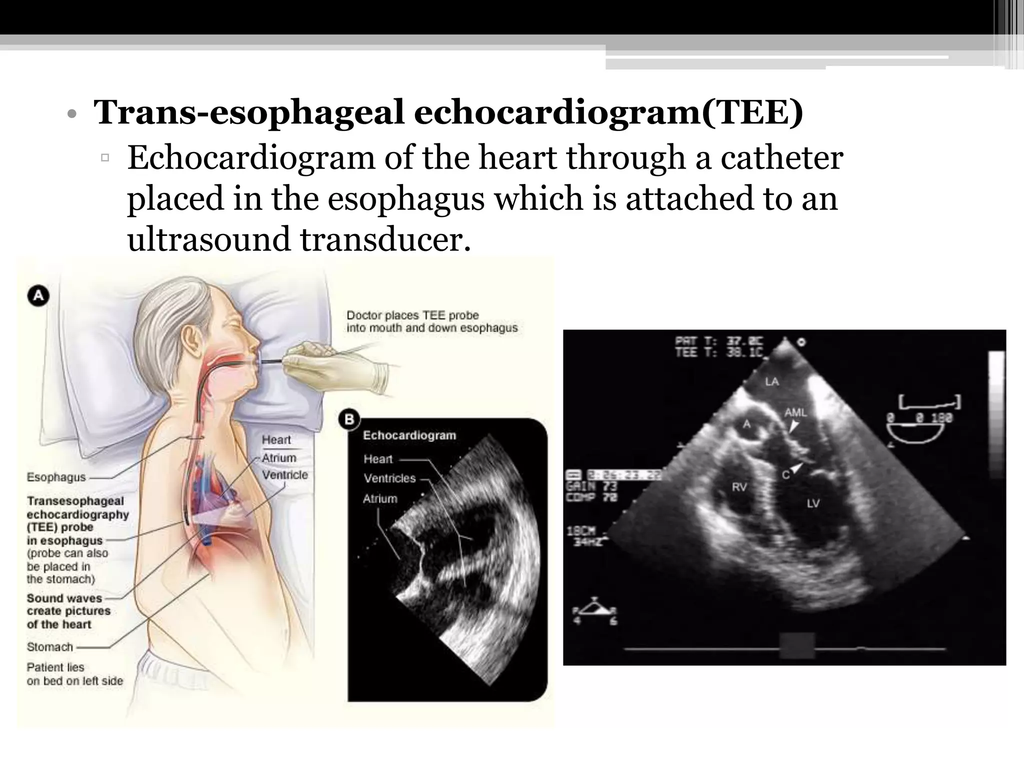 Diagnostic Investigations of Cardiovascular System | PPTX