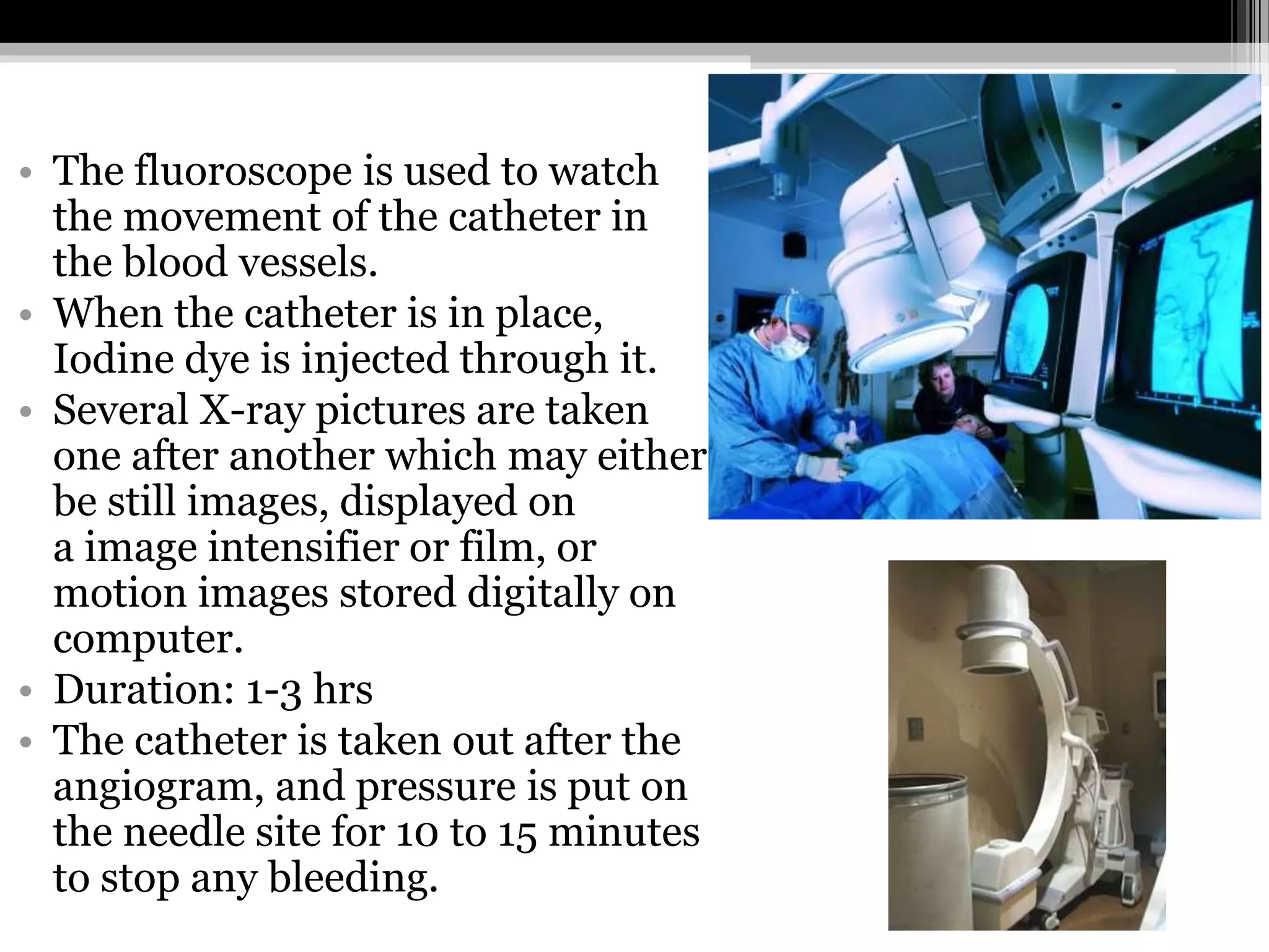 Diagnostic Investigations of Cardiovascular System | PPTX