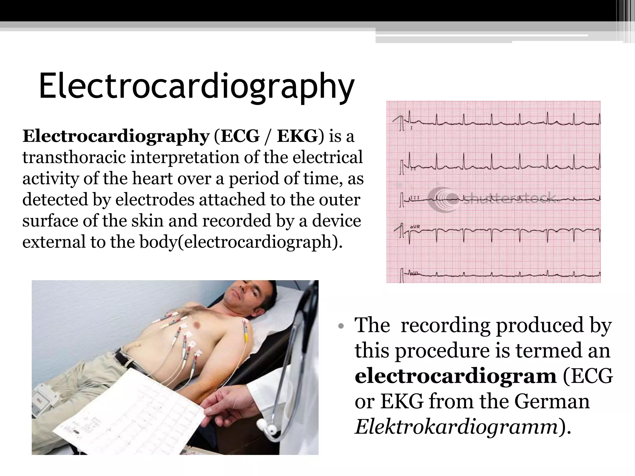 Diagnostic Investigations of Cardiovascular System | PPTX