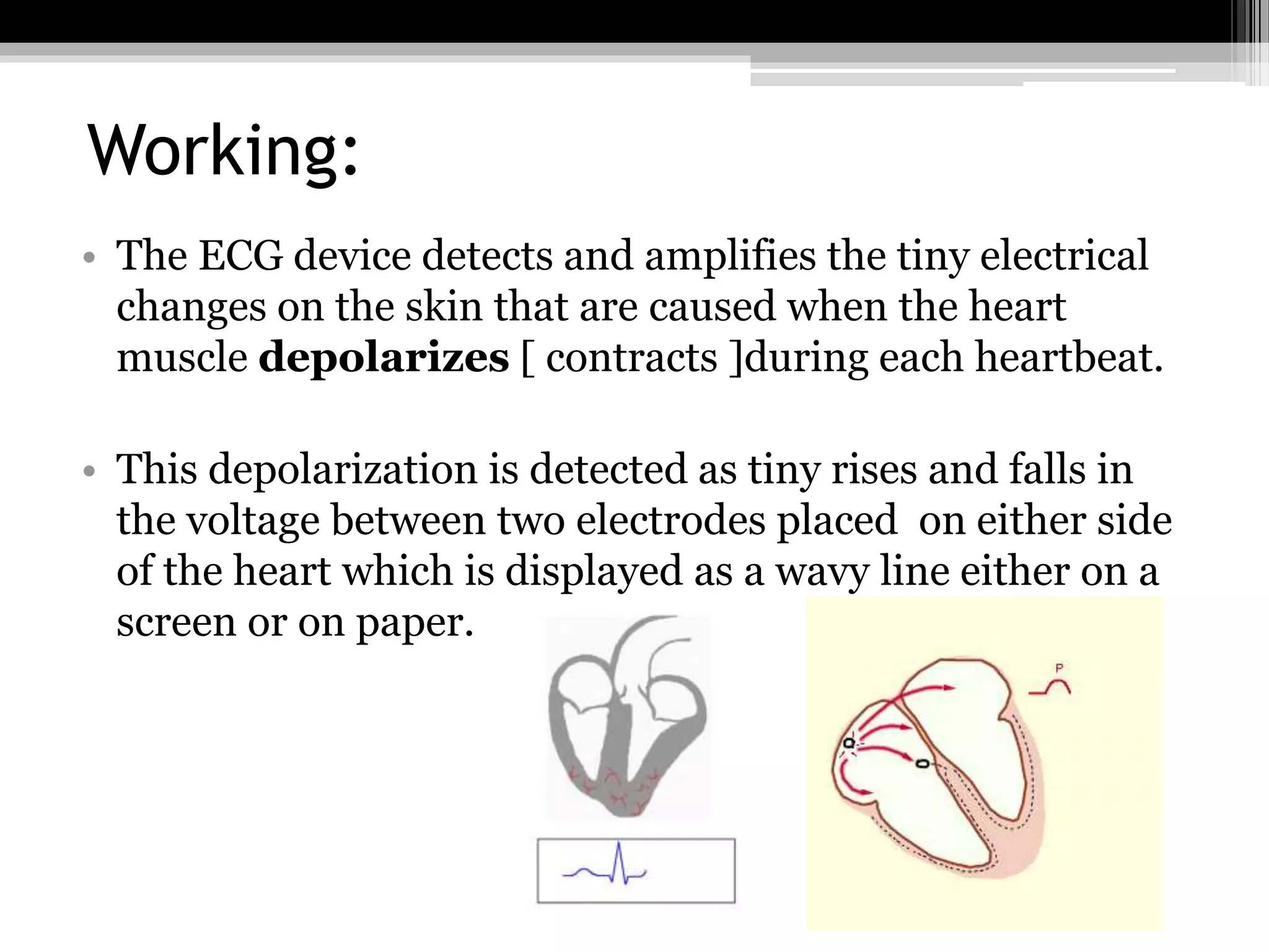 Diagnostic Investigations of Cardiovascular System | PPTX