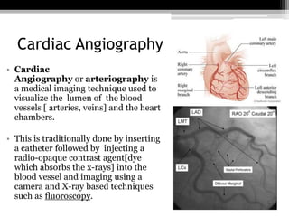 Diagnostic Investigations of Cardiovascular System | PPTX