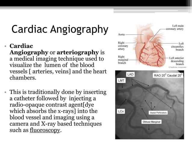 Diagnostic Investigations of Cardiovascular System | PPTX
